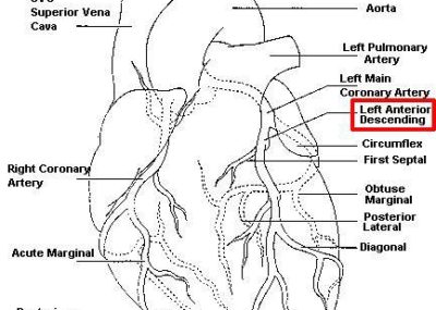 The Widowmaker - Marshmallow Ranch