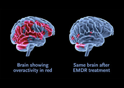 50,000 Mile Tune-Up...or...How EMDR Saves My Brain - Marshmallow Ranch